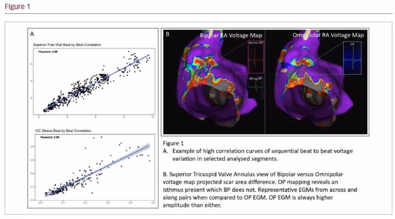 47/Omnipolar Electrograms are more consistent and improve substrate ...